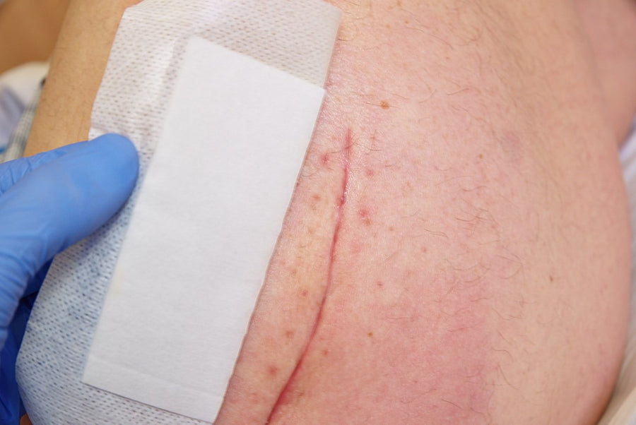 Gifts For Cancer Patients | Cancer Care Packages Australia – HOPE